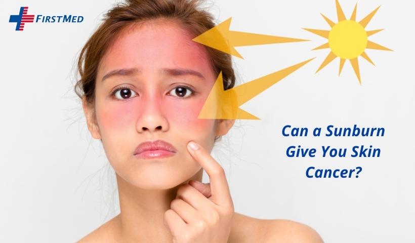 FirstMed: Can a Sunburn Give You Skin Cancer? | AmCham